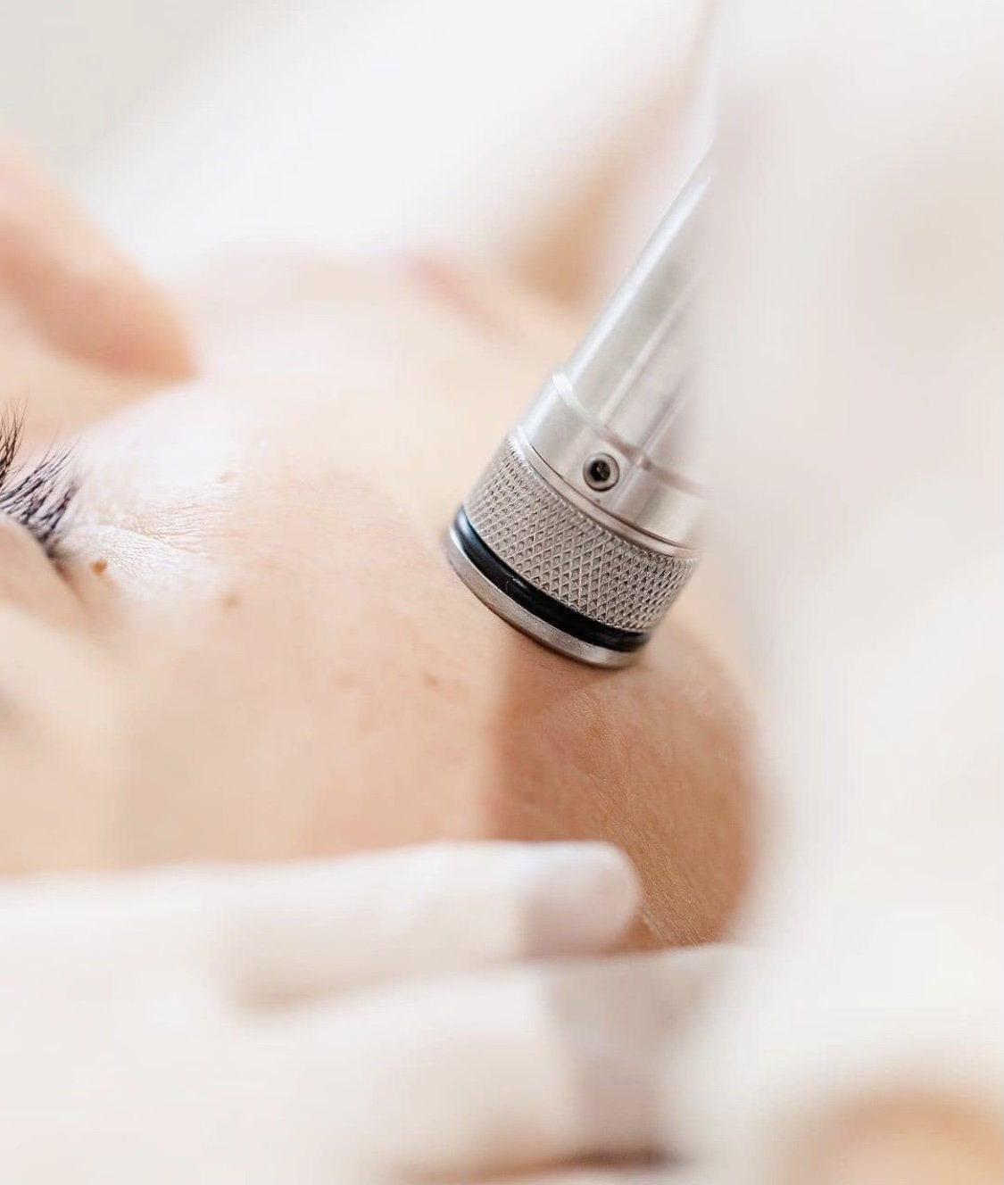 Hydrabrasion Facial — Martindale Medispa